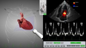 Ecocardiograma com doppler: o que é, como é feito e para que serve ...